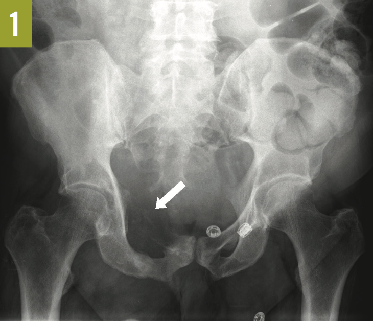 A Collection of Cancerous Conditions | Consultant360